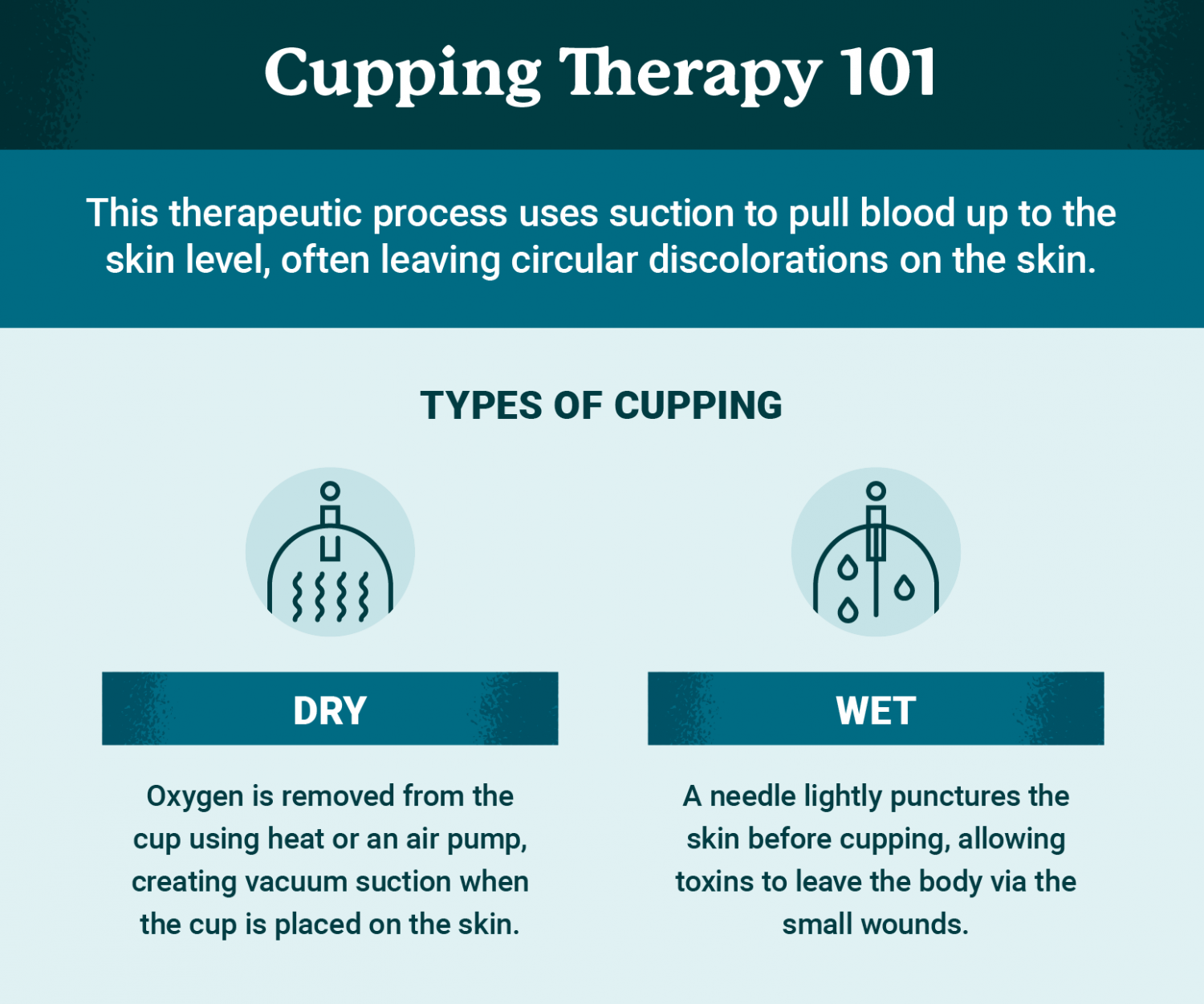 What Is Cupping Therapy? Benefits and Applications | USAHS